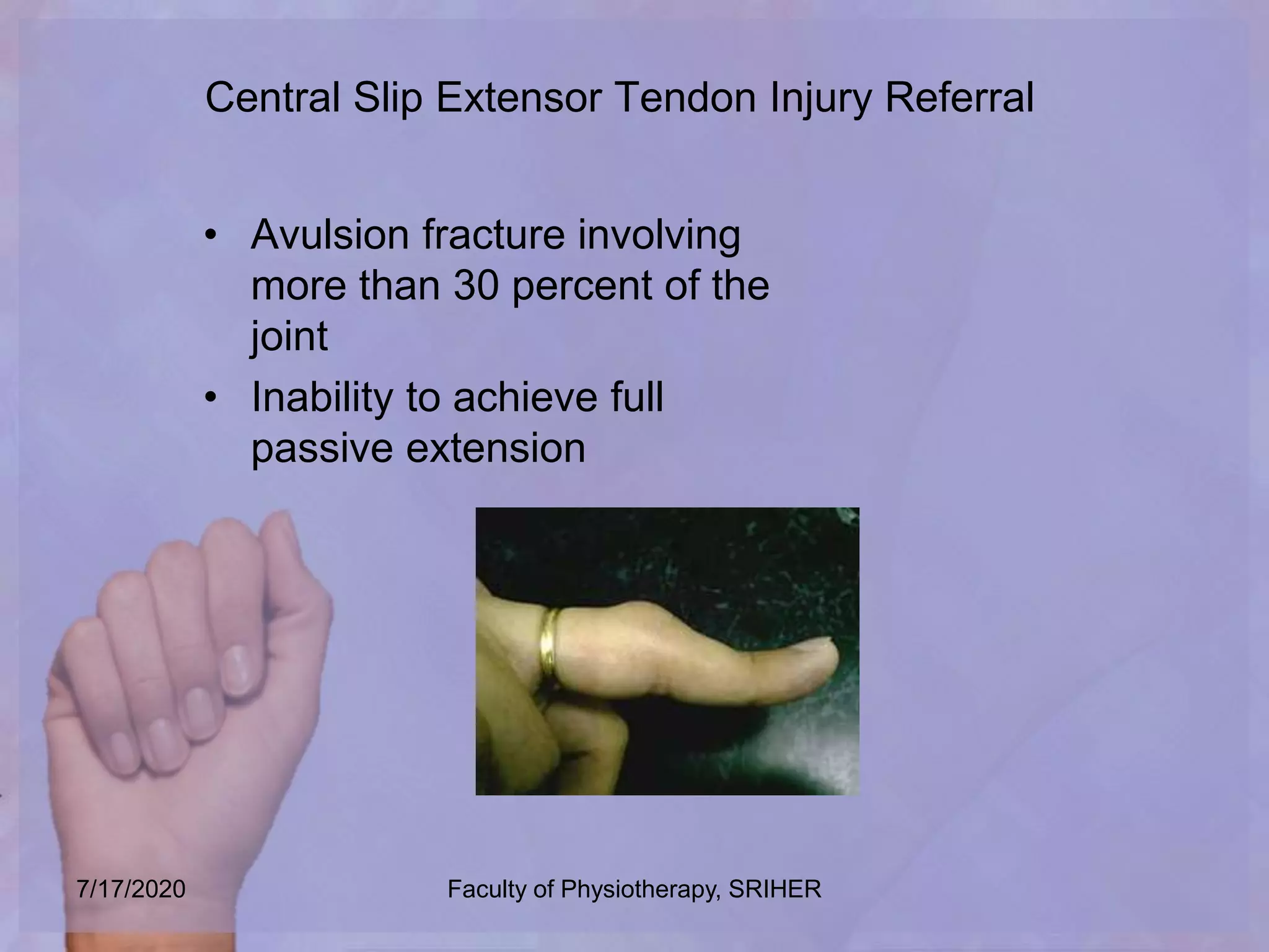 Soft tissue lesion hand | PPTX