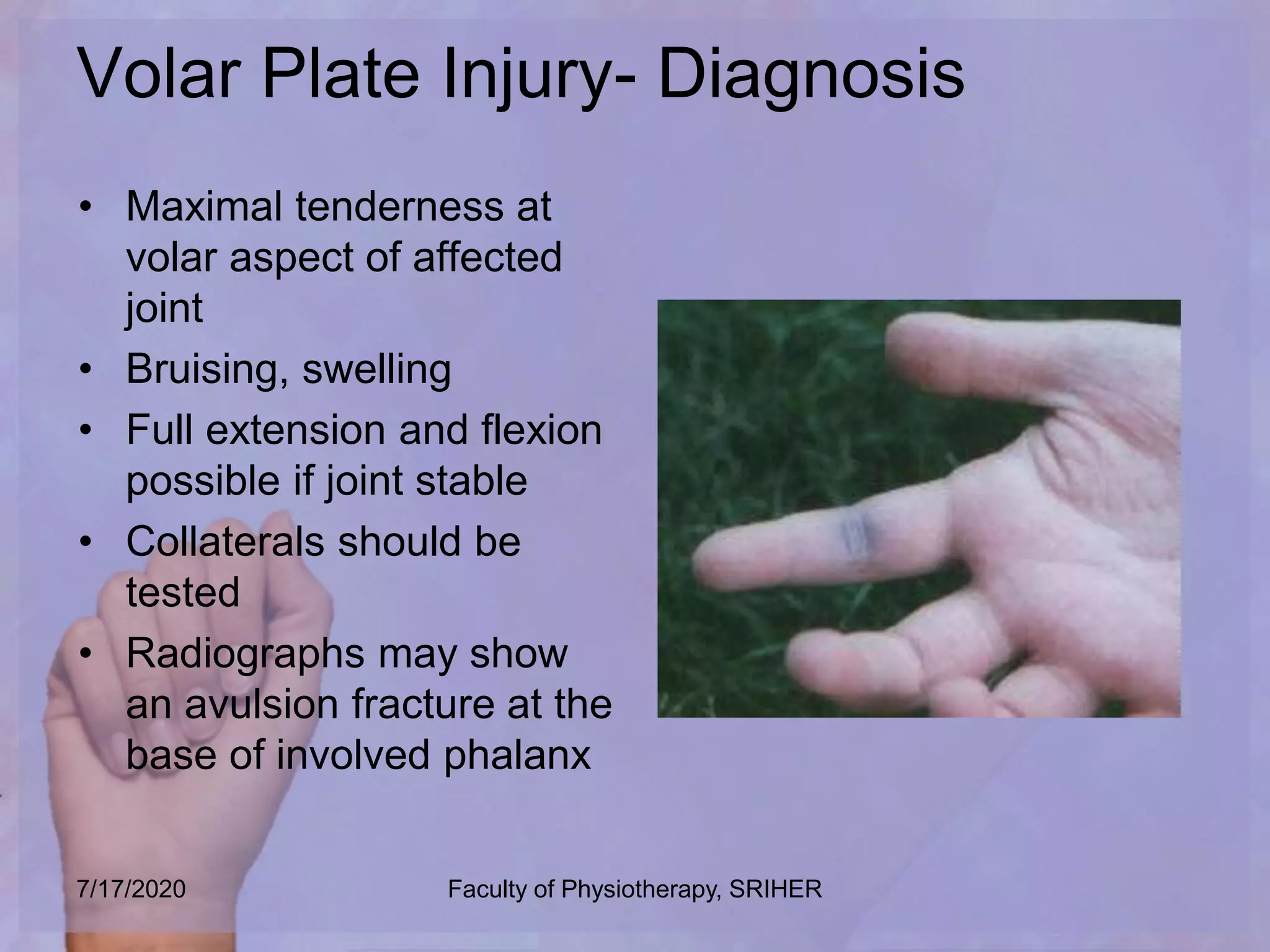 Soft tissue lesion hand | PPTX