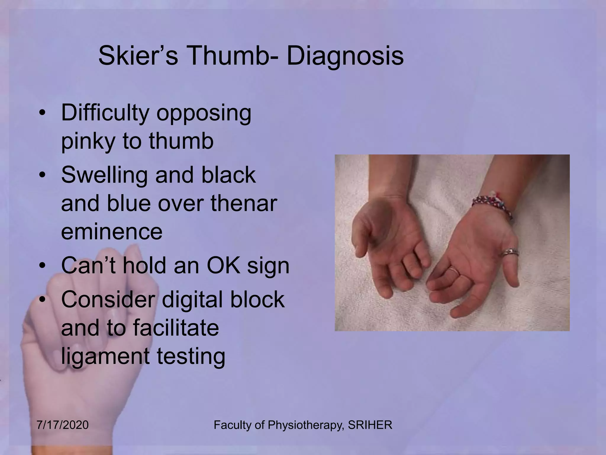 Soft tissue lesion hand | PPTX