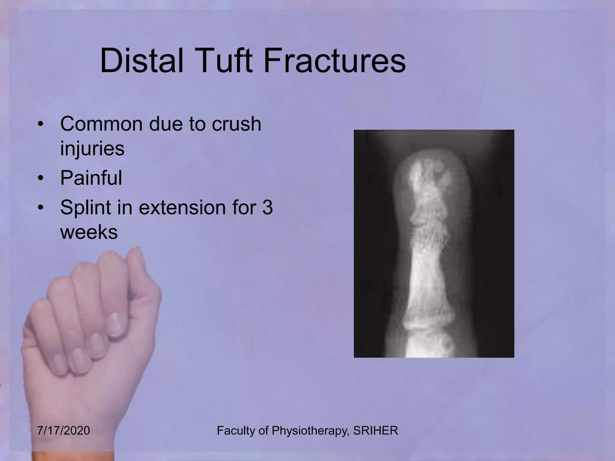 Soft tissue lesion hand | PPTX