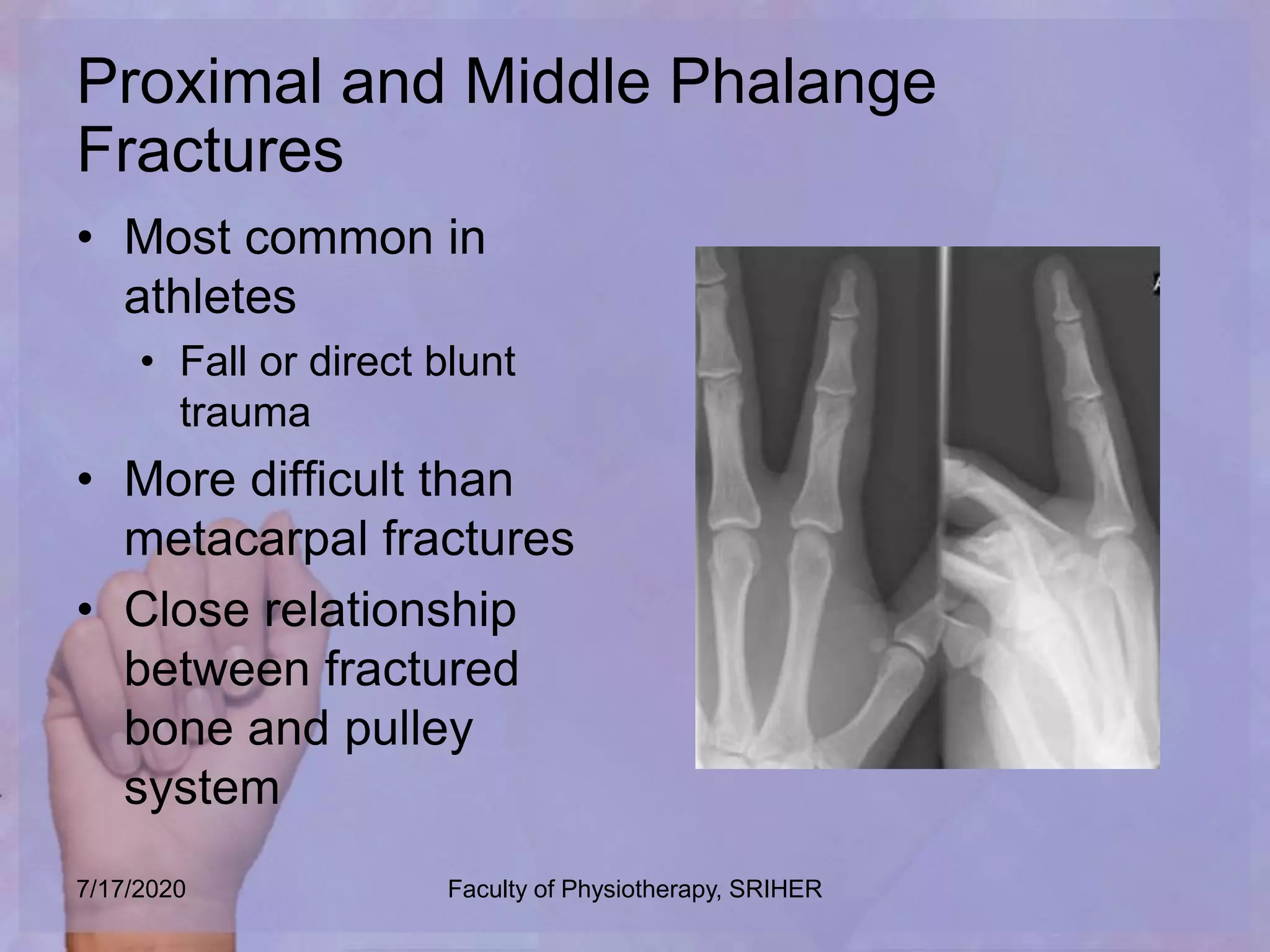 Soft tissue lesion hand | PPTX