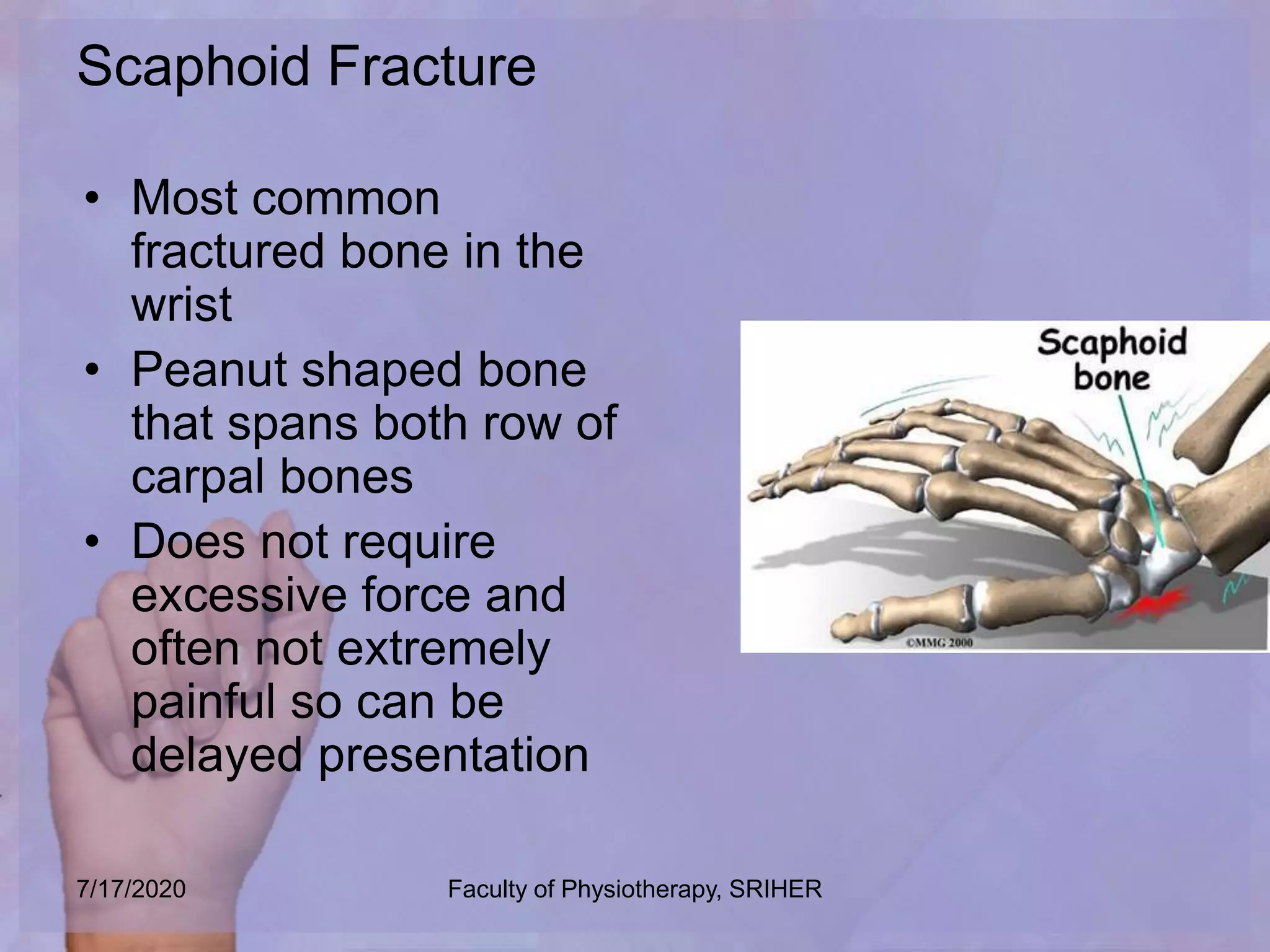 Soft tissue lesion hand | PPTX
