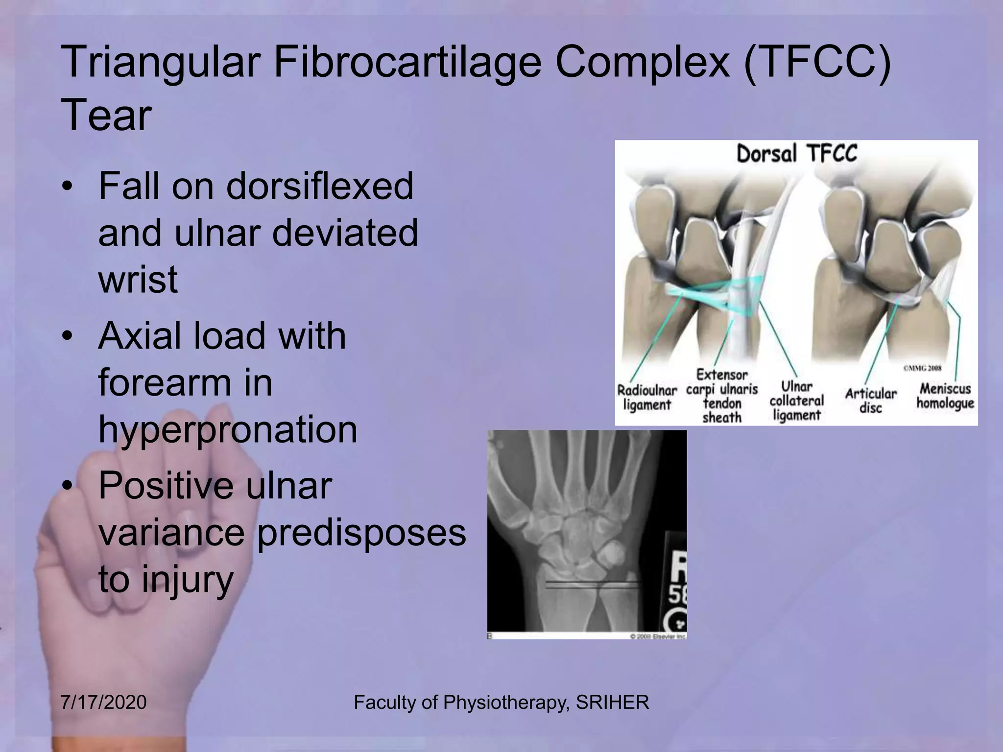Soft tissue lesion hand | PPTX