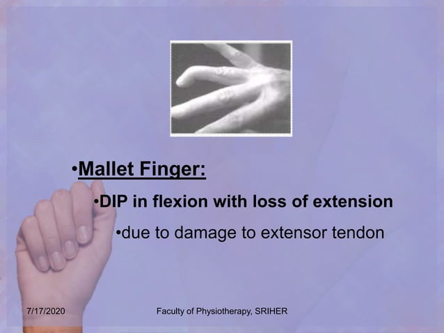 Soft tissue lesion hand | PPTX