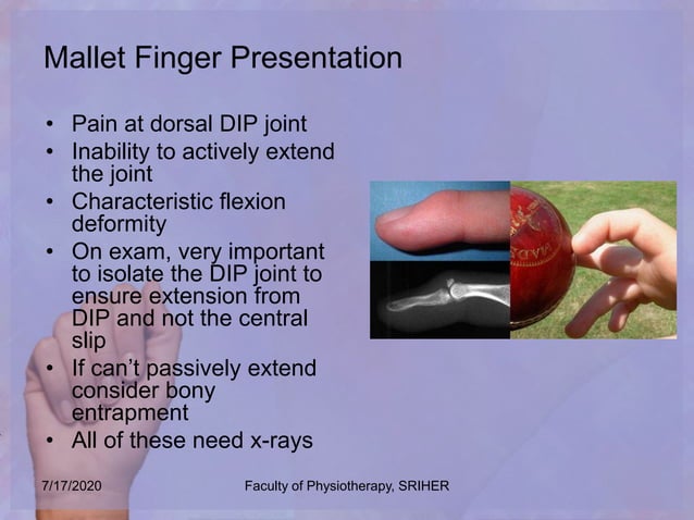 Soft tissue lesion hand | PPTX