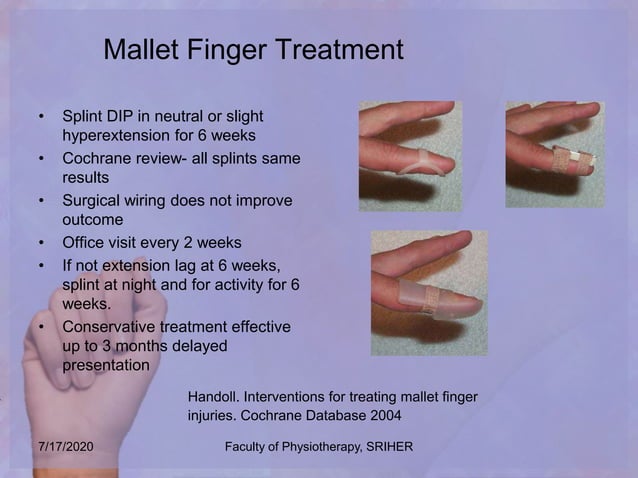 Soft tissue lesion hand | PPTX