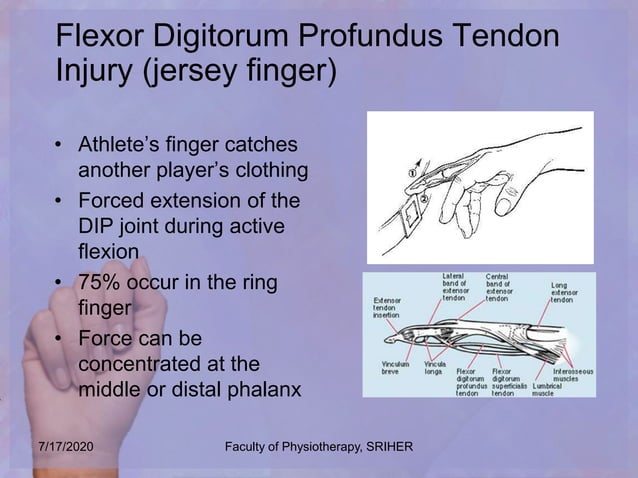 Soft tissue lesion hand | PPTX