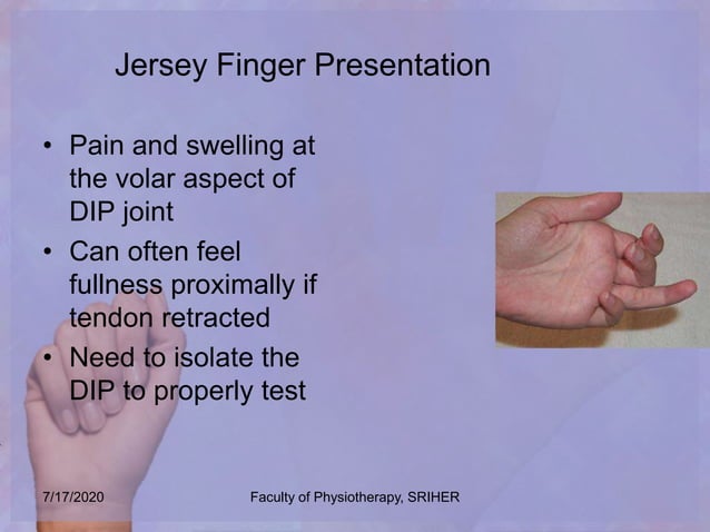 Soft tissue lesion hand | PPTX
