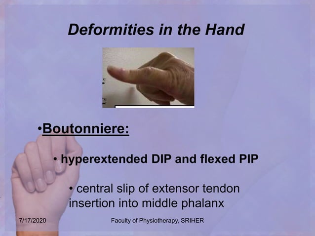 Soft tissue lesion hand | PPTX