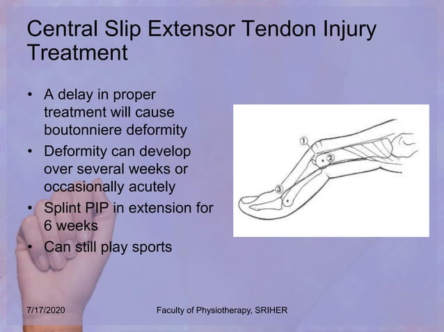Soft tissue lesion hand | PPTX