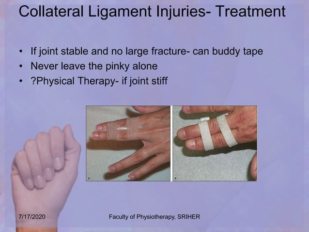 Soft tissue lesion hand | PPTX