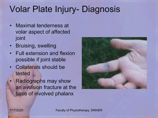 Soft tissue lesion hand | PPTX