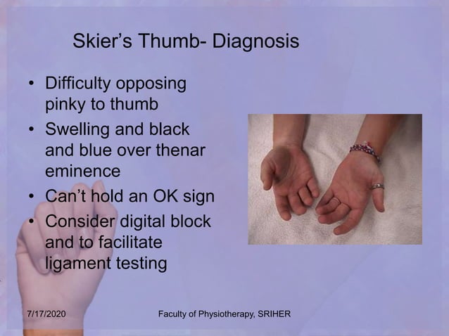 Soft tissue lesion hand | PPTX