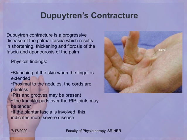 Soft tissue lesion hand | PPTX