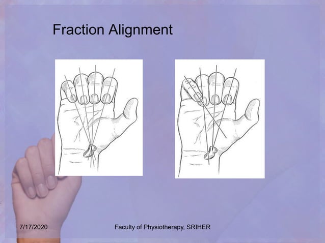 Soft tissue lesion hand | PPTX