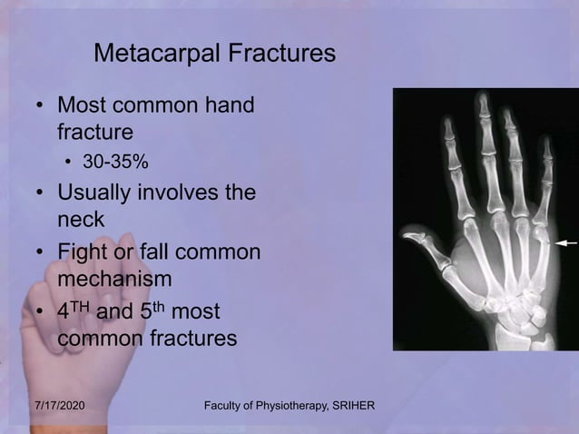 Soft tissue lesion hand | PPTX