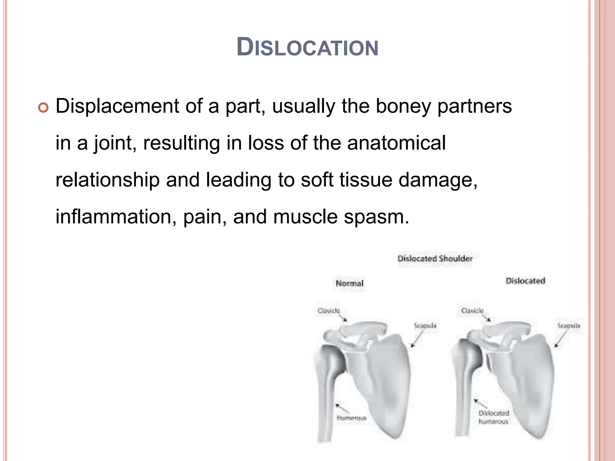Soft tissue lesions/sprain,strian,acute injury, subacute injury ...