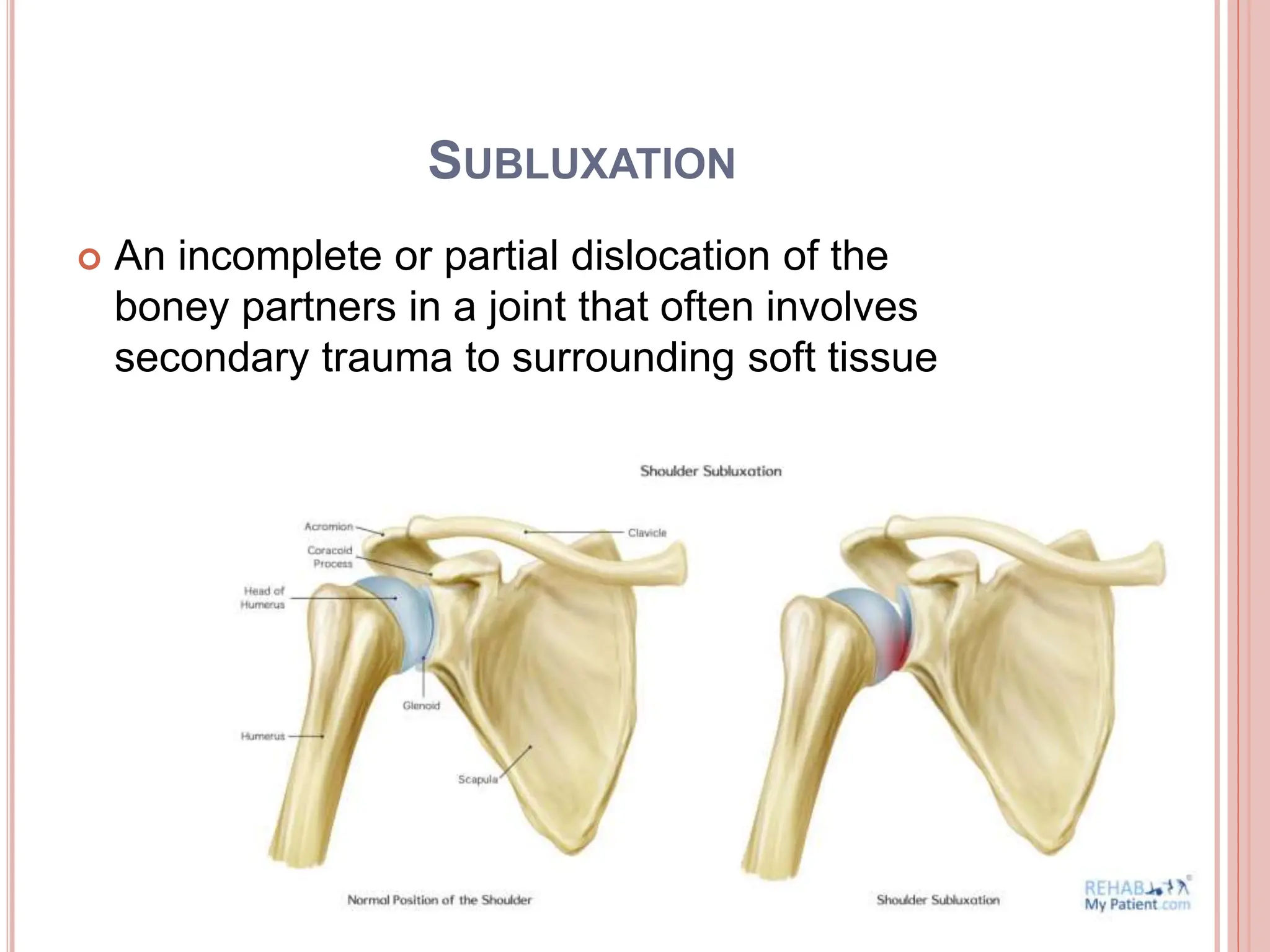 Soft tissue lesions/sprain,strian,acute injury, subacute injury ...