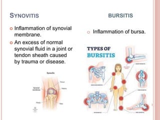 Soft tissue lesions/sprain,strian,acute injury, subacute injury ...