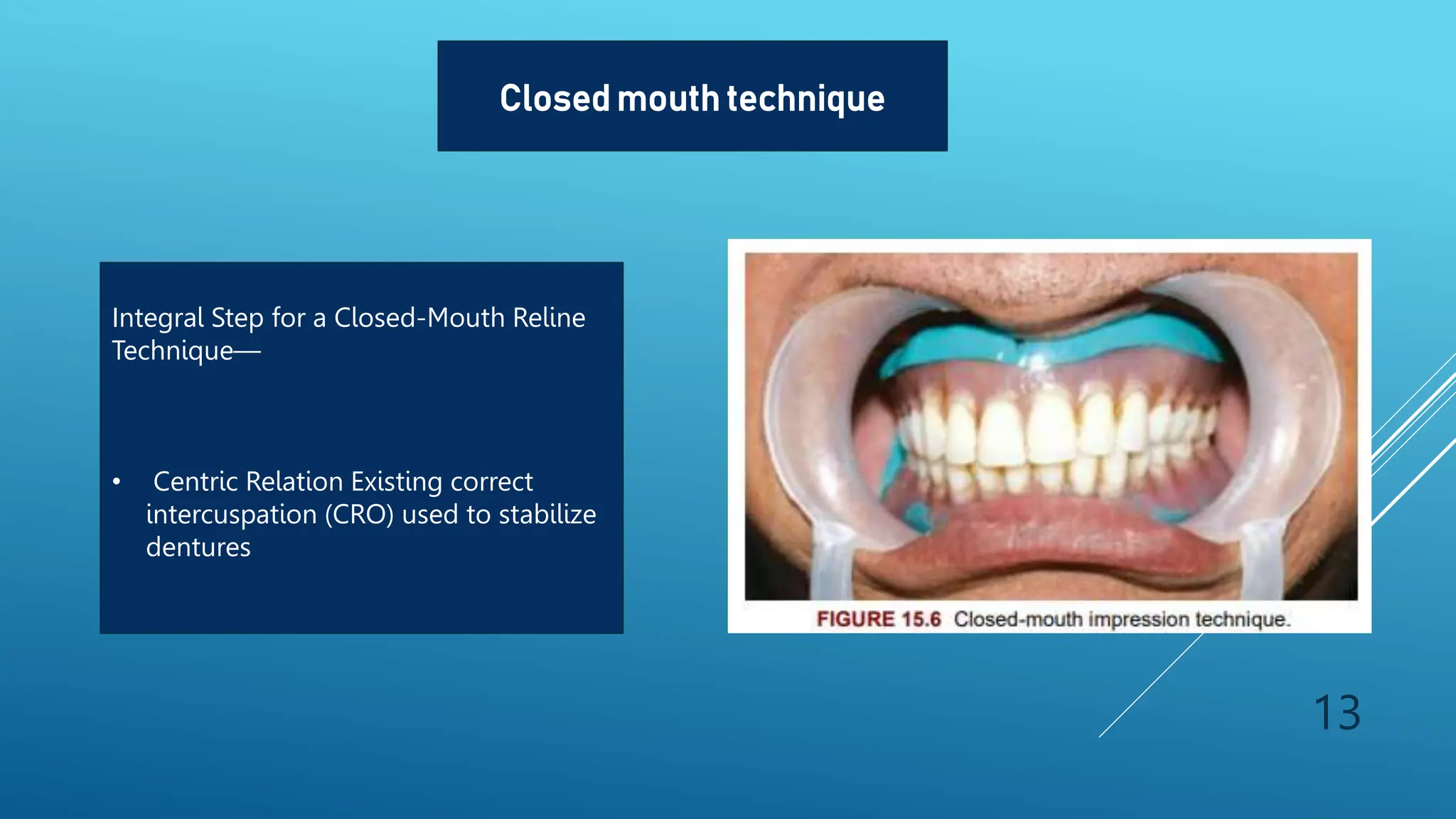 soft tissue liners and tissue conditioners - Copy.pptx