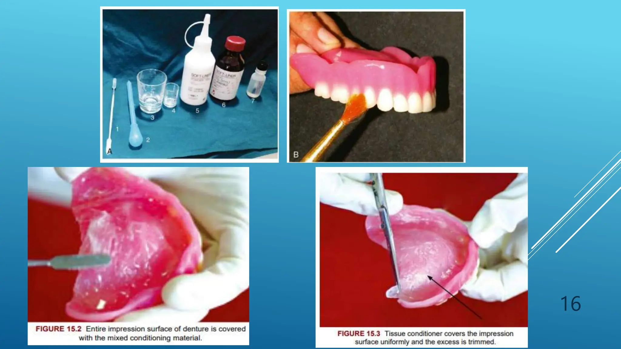 soft tissue liners and tissue conditioners - Copy.pptx