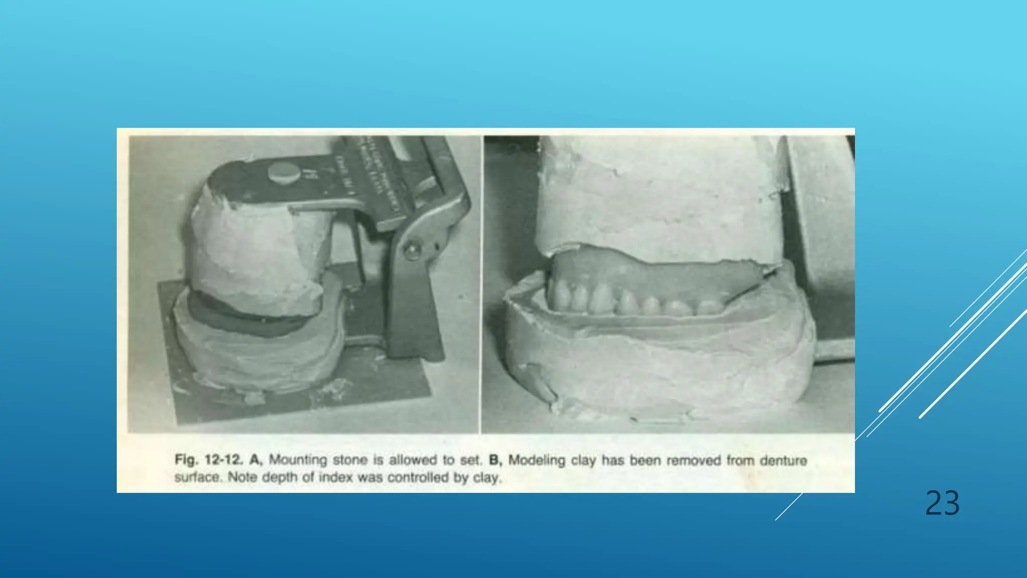 soft tissue liners and tissue conditioners - Copy.pptx