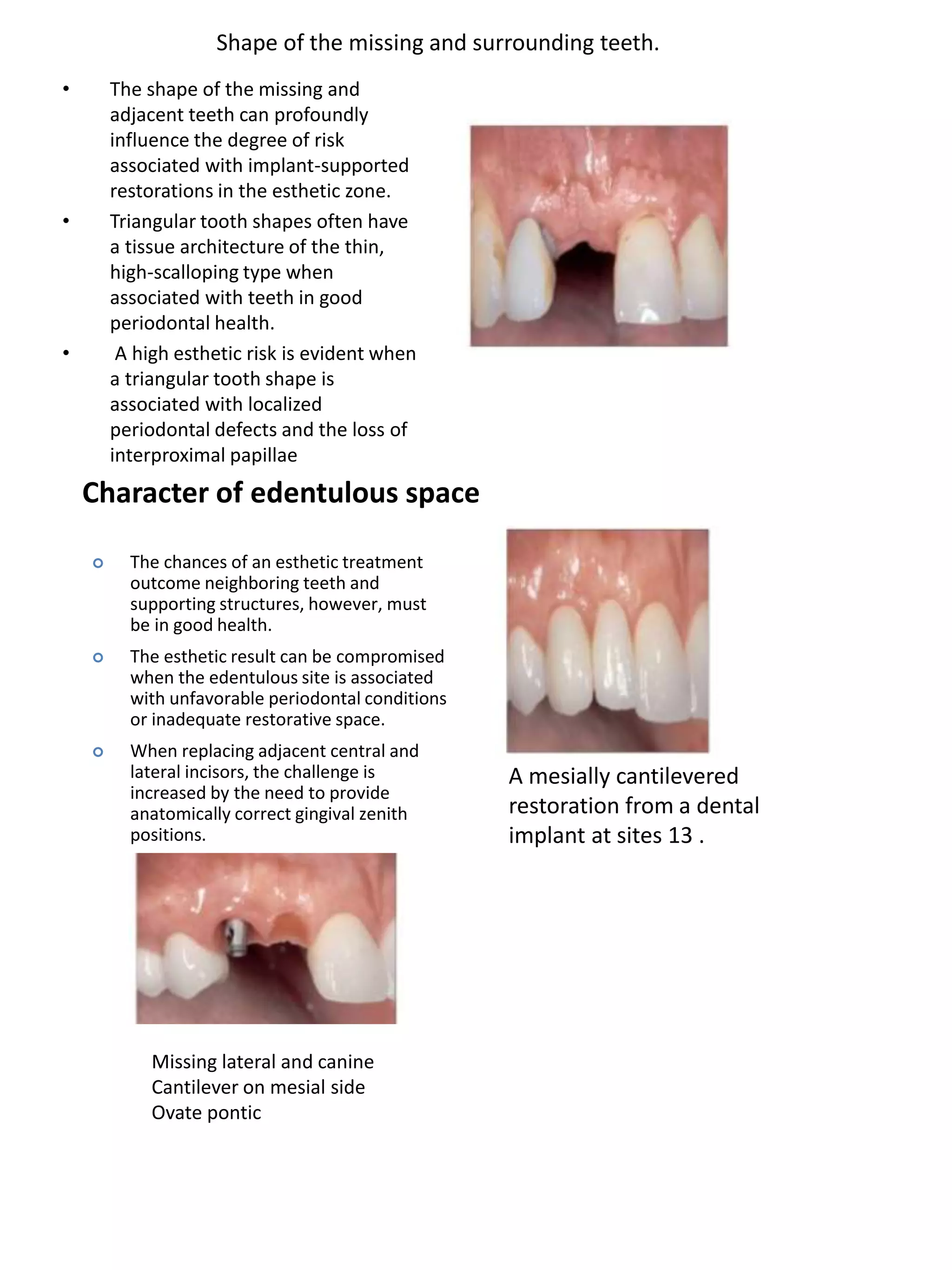 Soft tissue management around dental implant | PPTX