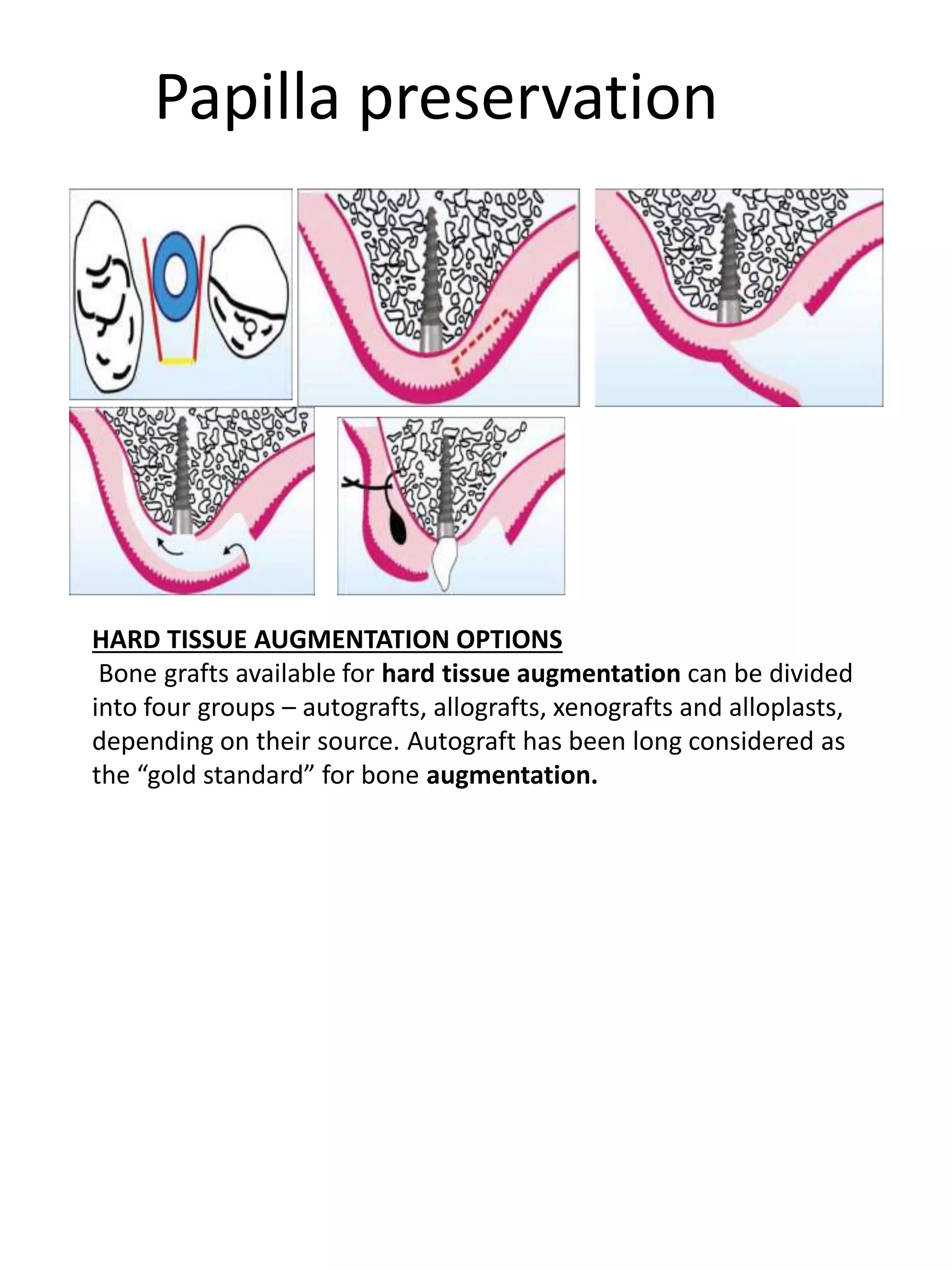 Soft tissue management around dental implant | PPTX