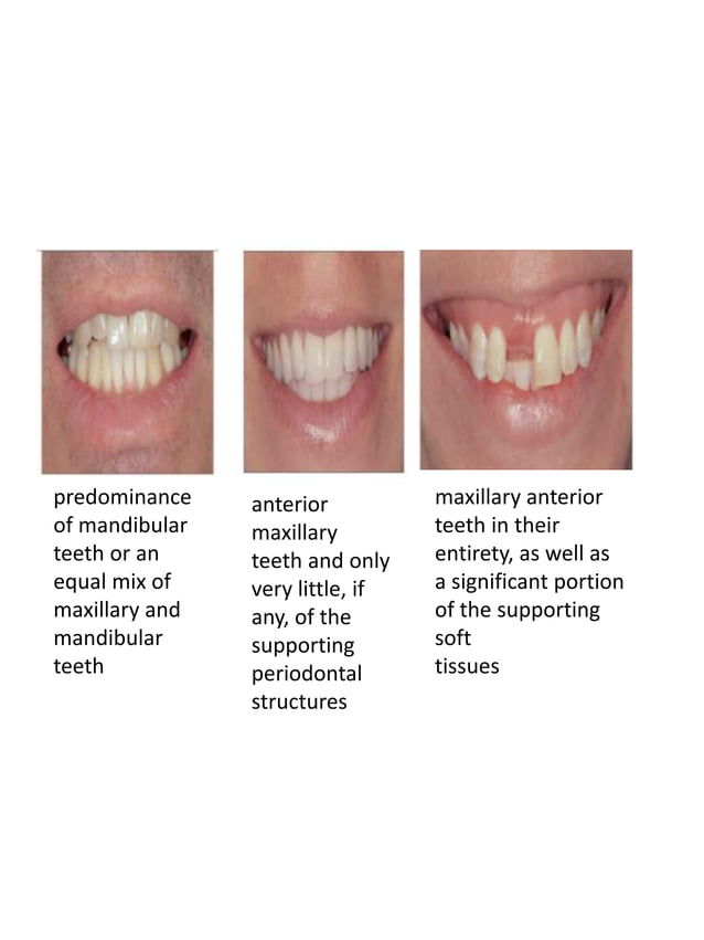 Soft tissue management around dental implant | PPTX
