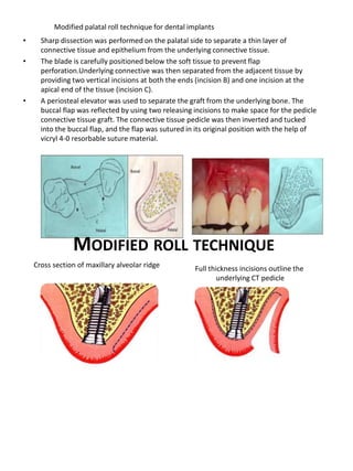 Soft tissue management around dental implant | PPTX