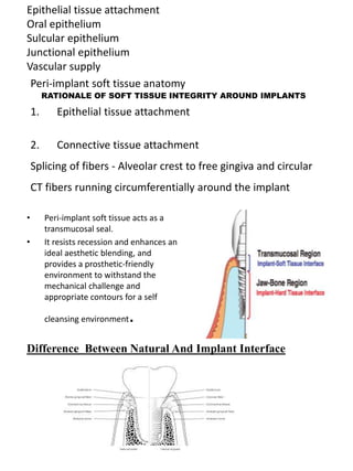 Soft tissue management around dental implant | PPTX