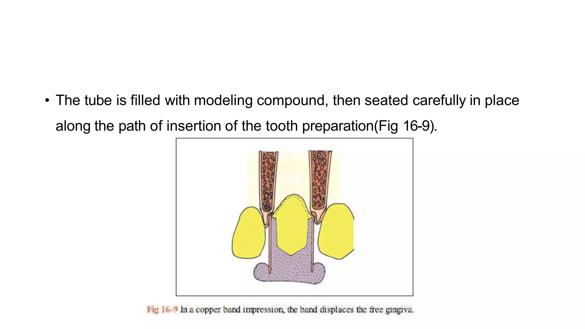 SOFT TISSUE MANAGEMENT IN FPD.pptx
