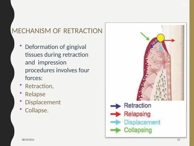SOFT TISSUE MANAGEMENT IN FIXED PARTIAL DENTURE | PPTX
