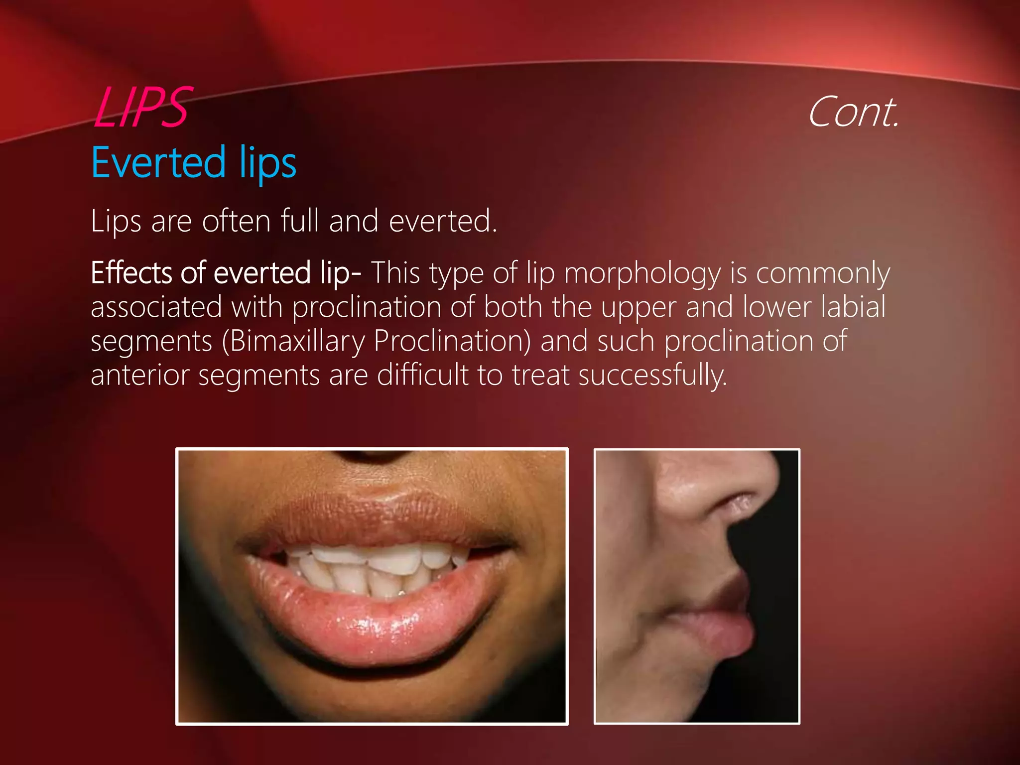Soft tissue morphology | PPTX