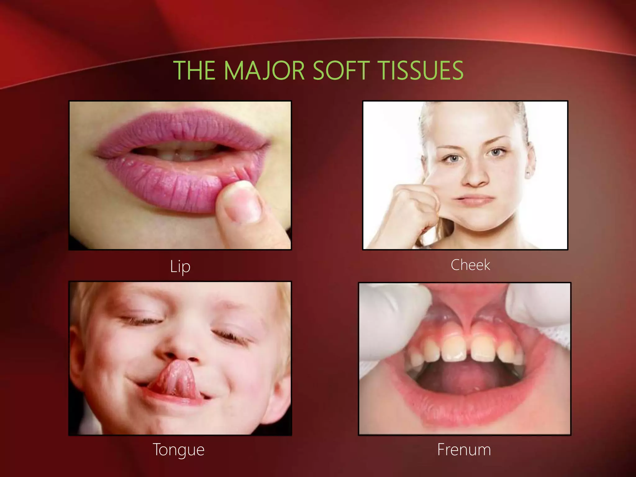 Soft tissue morphology | PPTX