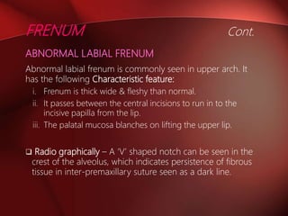 Soft tissue morphology | PPTX