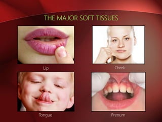 Soft tissue morphology | PPTX