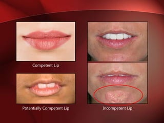 Soft tissue morphology | PPT