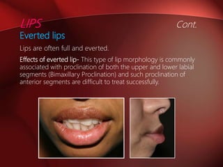 Soft tissue morphology | PPT