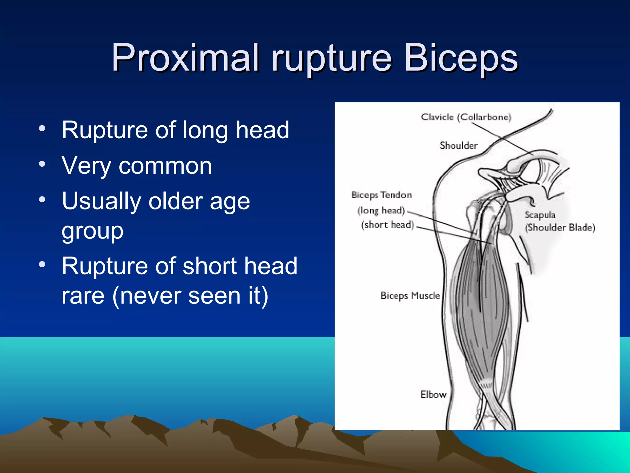 Soft tissue msk injuries | PPT