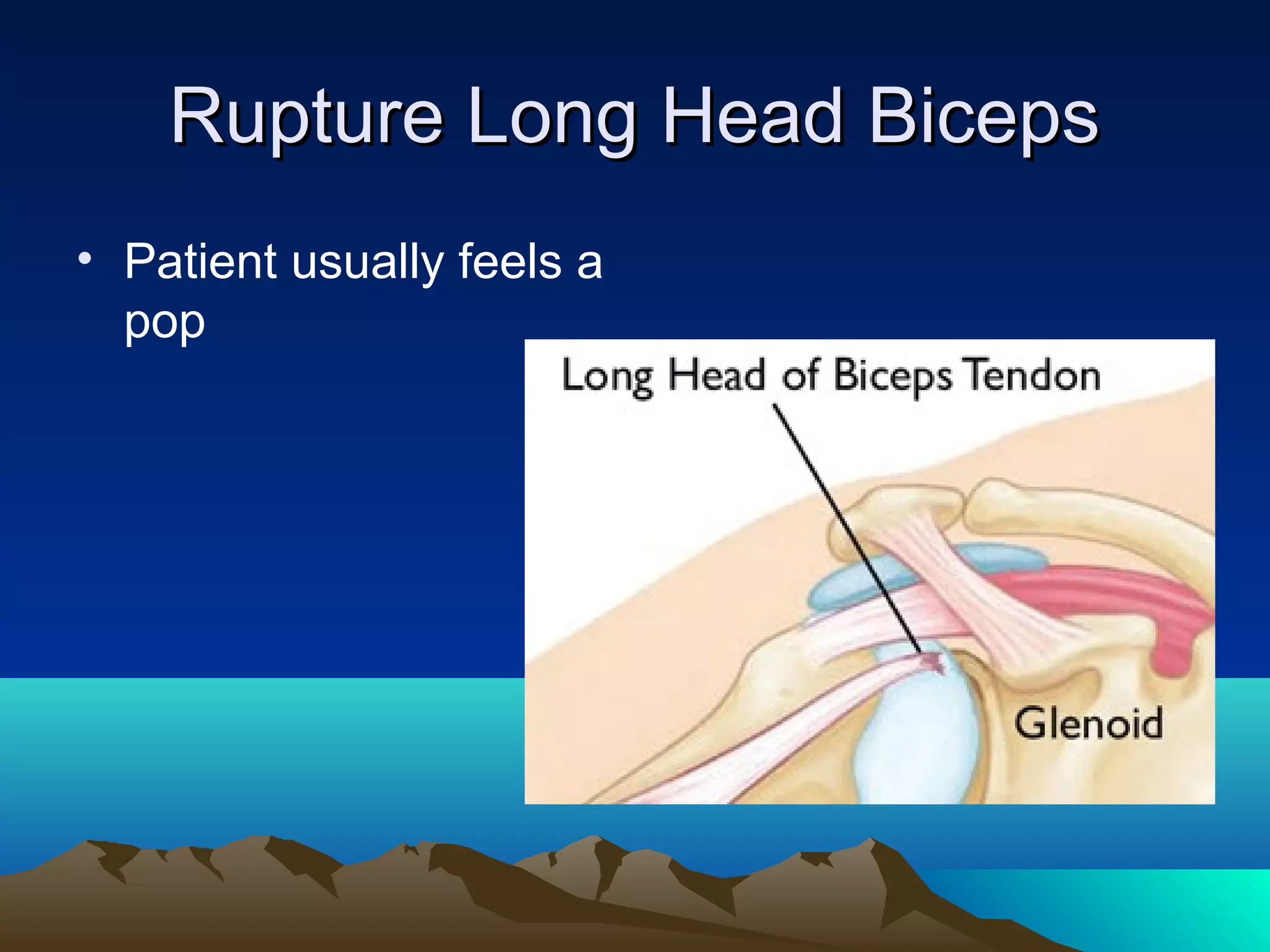 Soft tissue msk injuries | PPT
