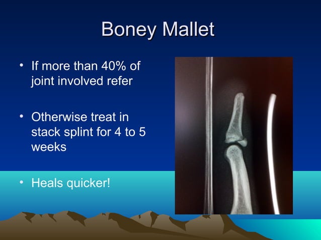 Soft tissue msk injuries | PPT