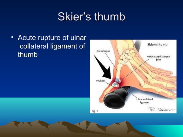 Soft tissue msk injuries | PPT