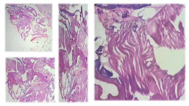 Soft tissue myiasis (MAGGOTS) || Simplified Explanation || Images ...