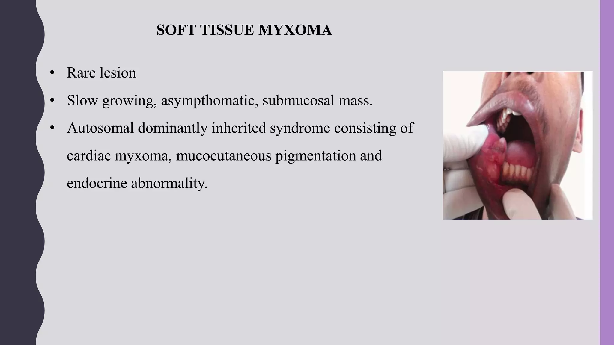Myxoma | PPTX