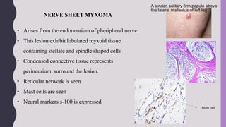 Myxoma | PPTX