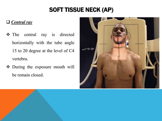 Soft tissue neck (upper airway) radiography | PPTX | Ear, Nose and Throat Conditions | Diseases ...