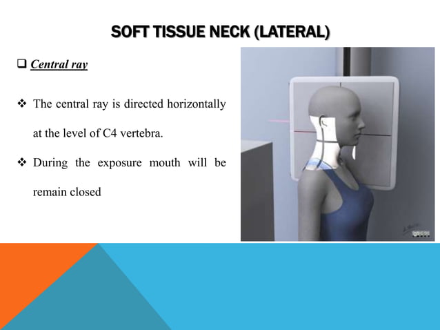 Soft tissue neck (upper airway) radiography | PPTX | Ear, Nose and ...