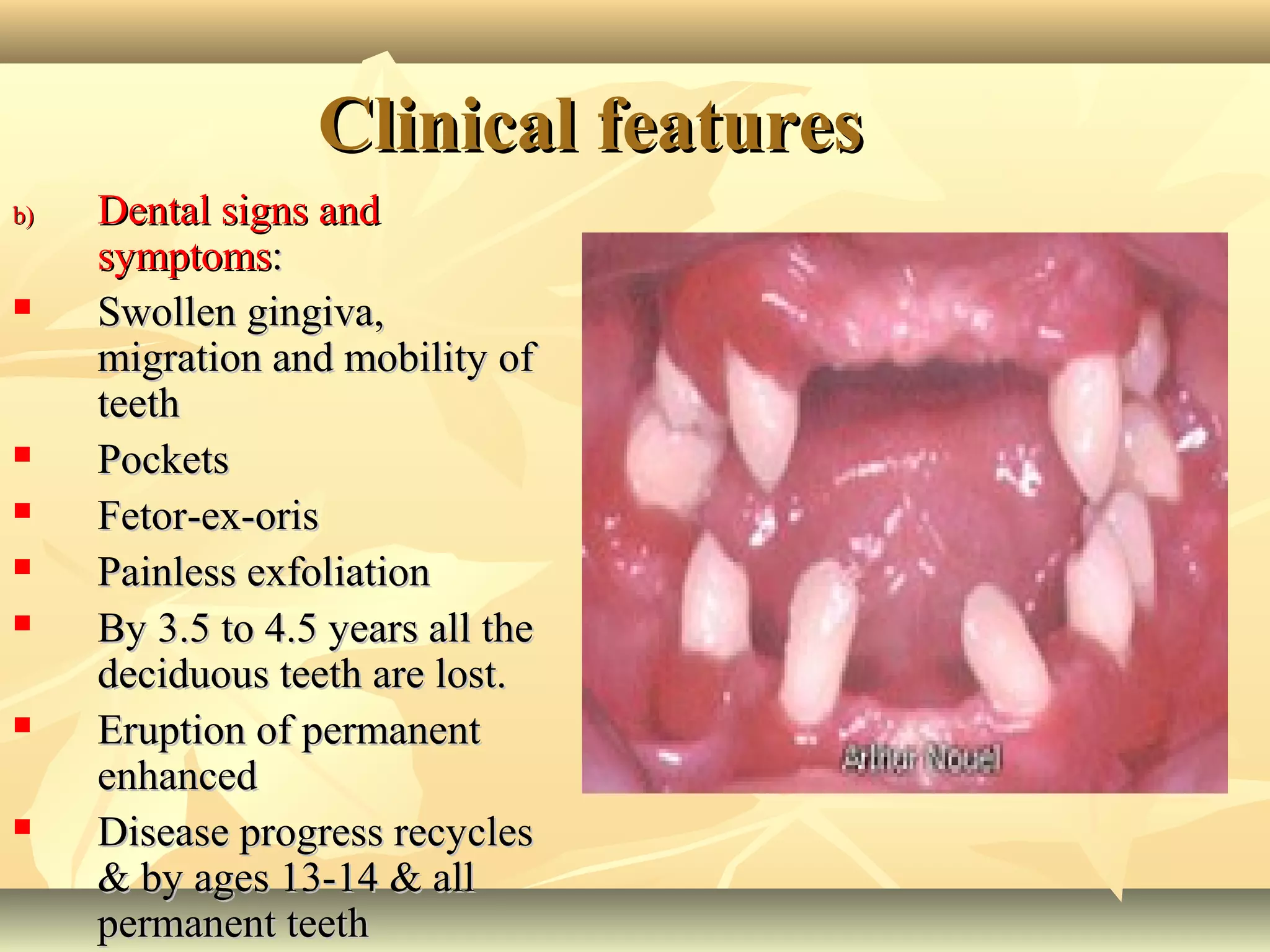 Soft tissue oral lesions in children | PPT