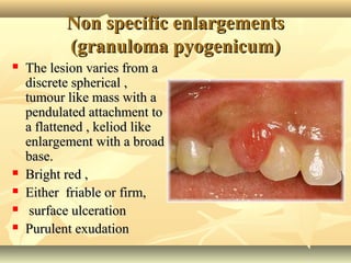 Soft tissue oral lesions in children | PPT